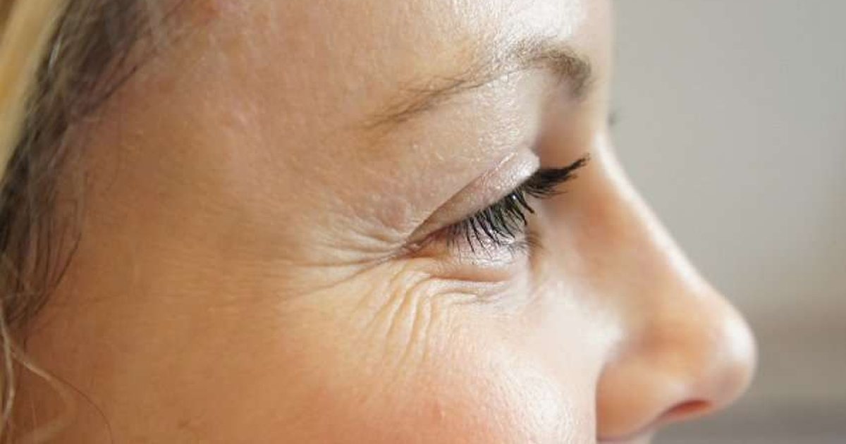 Rrudhat nuk vijnë vetëm nga mosha: Ja 4 faktorët e heshtur që ndikojnë ...